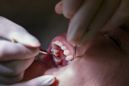 Gum Boil After Root Canal: Signs and Solutions | Hyster Home